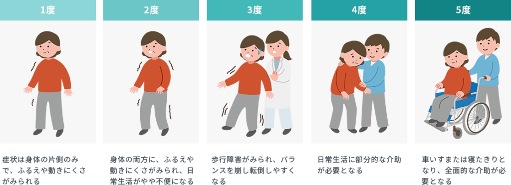 パーキンソン病の症状と治療法 - 一般社団法人 日本定位・機能神経外科学会